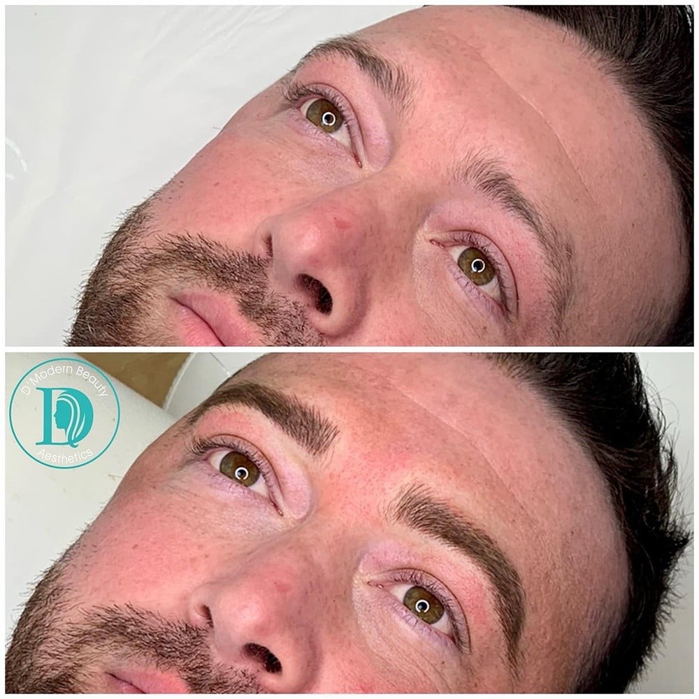 What is Eyebrow Microblading & Everything You Need to Know