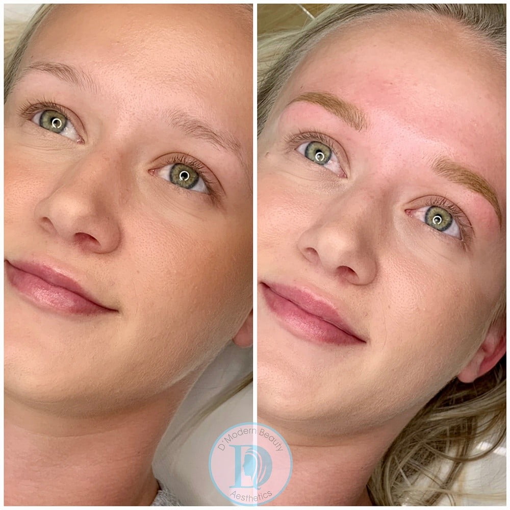 The Revolutionary History of Microblading | #1 OC Eyebrow Microblading